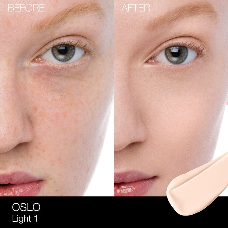 nars oslo foundation